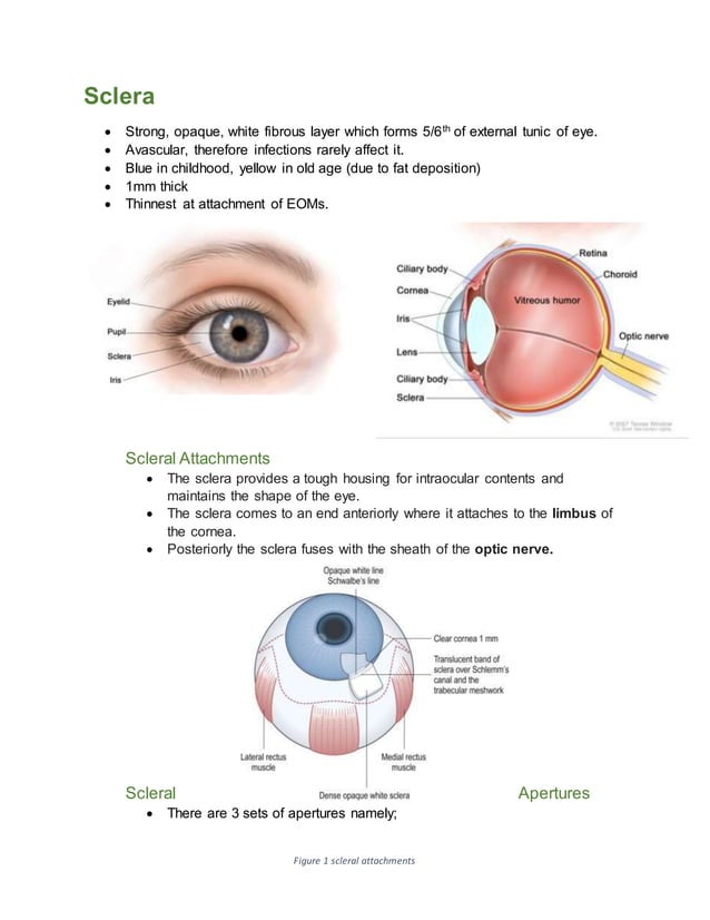 Sclera (scleritis and episcleritis, staphyloma) | DOCX | Eye and Vision ...