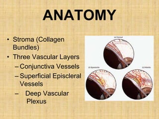 SCLERA.ppt | Eye and Vision Conditions | Diseases and Conditions