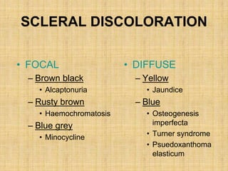 SCLERA.ppt | Eye and Vision Conditions | Diseases and Conditions