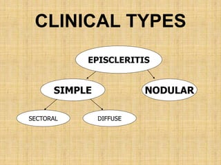 SCLERA.ppt | Eye and Vision Conditions | Diseases and Conditions