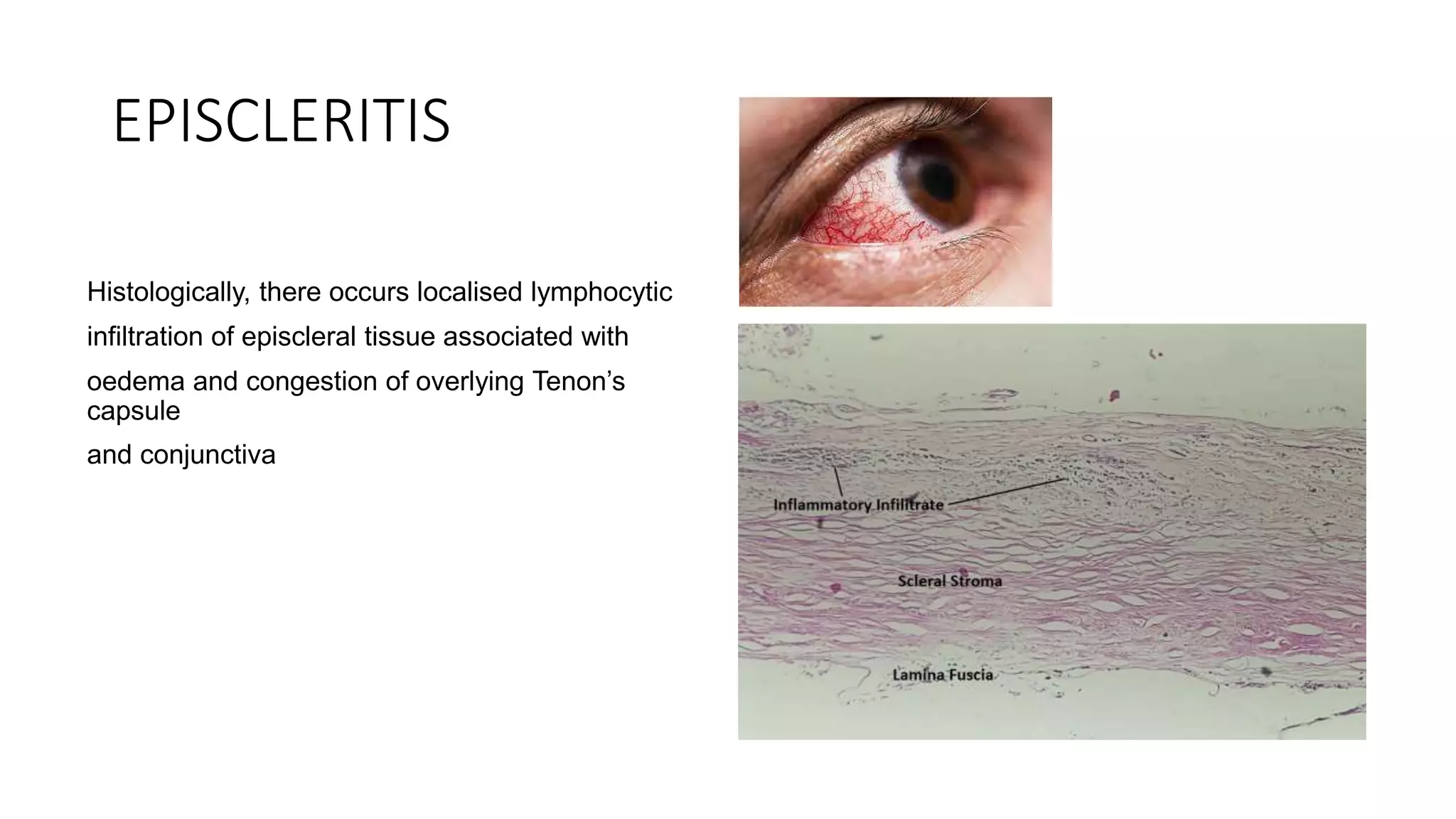 SCLERA.pptx