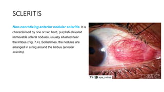 SCLERA.pptx