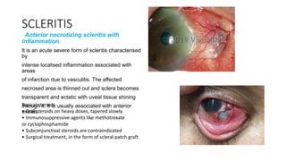 SCLERA.pptx
