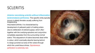 SCLERA.pptx