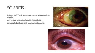 SCLERA.pptx