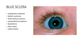 SCLERA.pptx