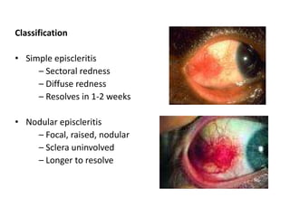 Sclera 7.4.16 dr.n.swathi | PPT