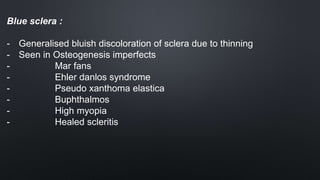 Sclera | PPTX