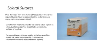 Scleral buckling for rhegmatogenous retinal detachment | PPTX