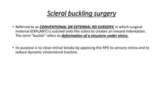 Scleral buckling for rhegmatogenous retinal detachment | PPTX
