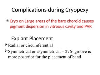Scleral Buckling Materials and methods.pptx