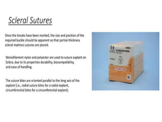 Scleral Buckling Materials and methods.pptx
