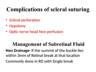 Scleral Buckling Materials and methods.pptx