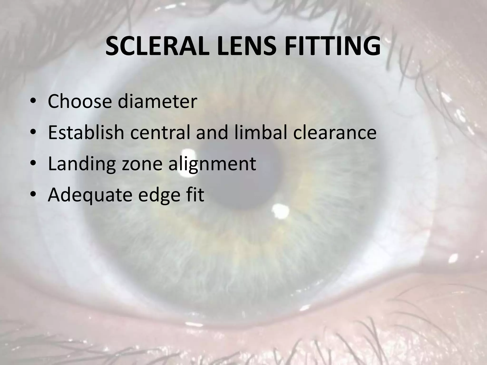 Scleral contact lens in Ophthalmology | PPTX