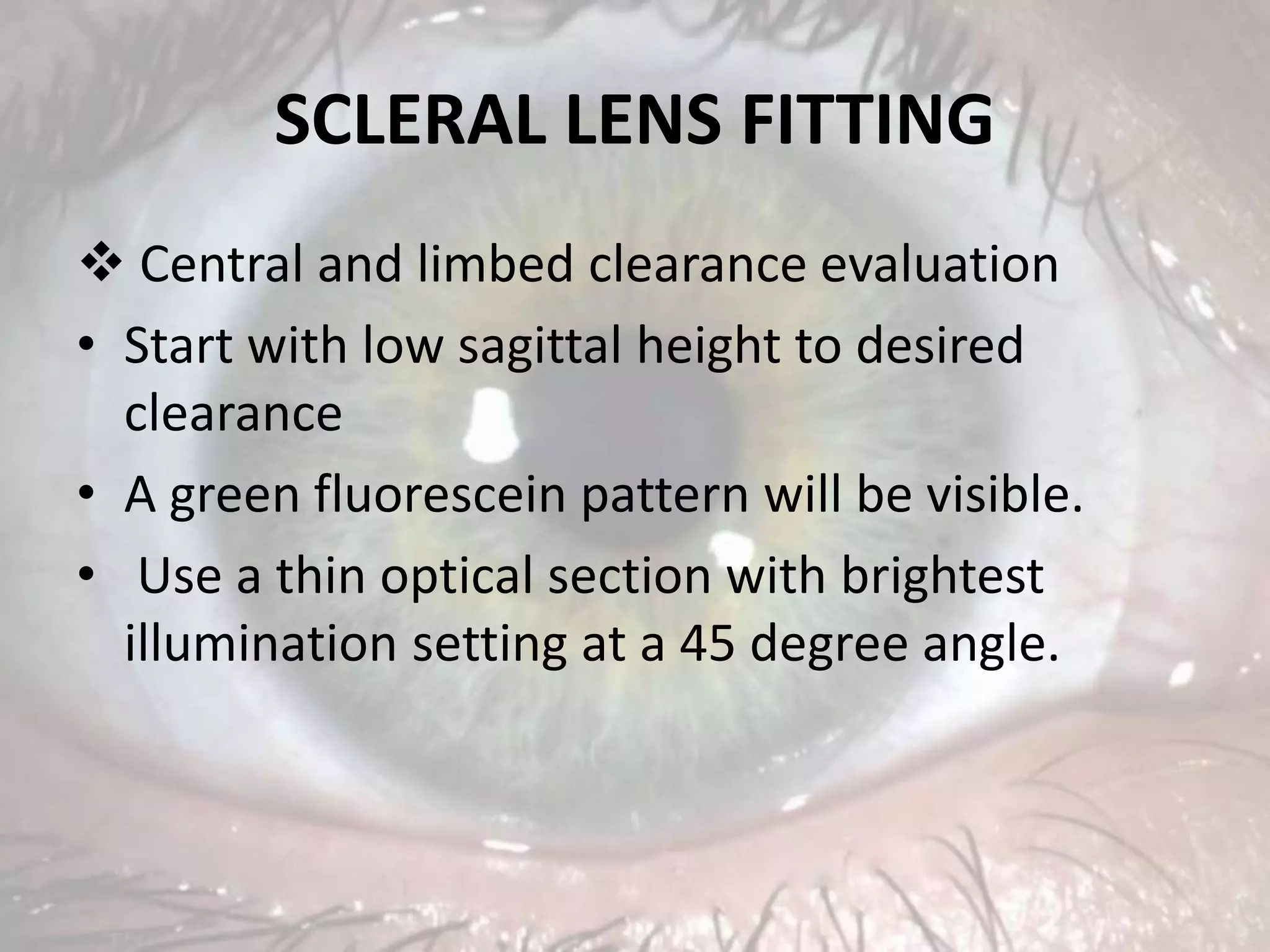 Scleral contact lens in Ophthalmology | PPTX