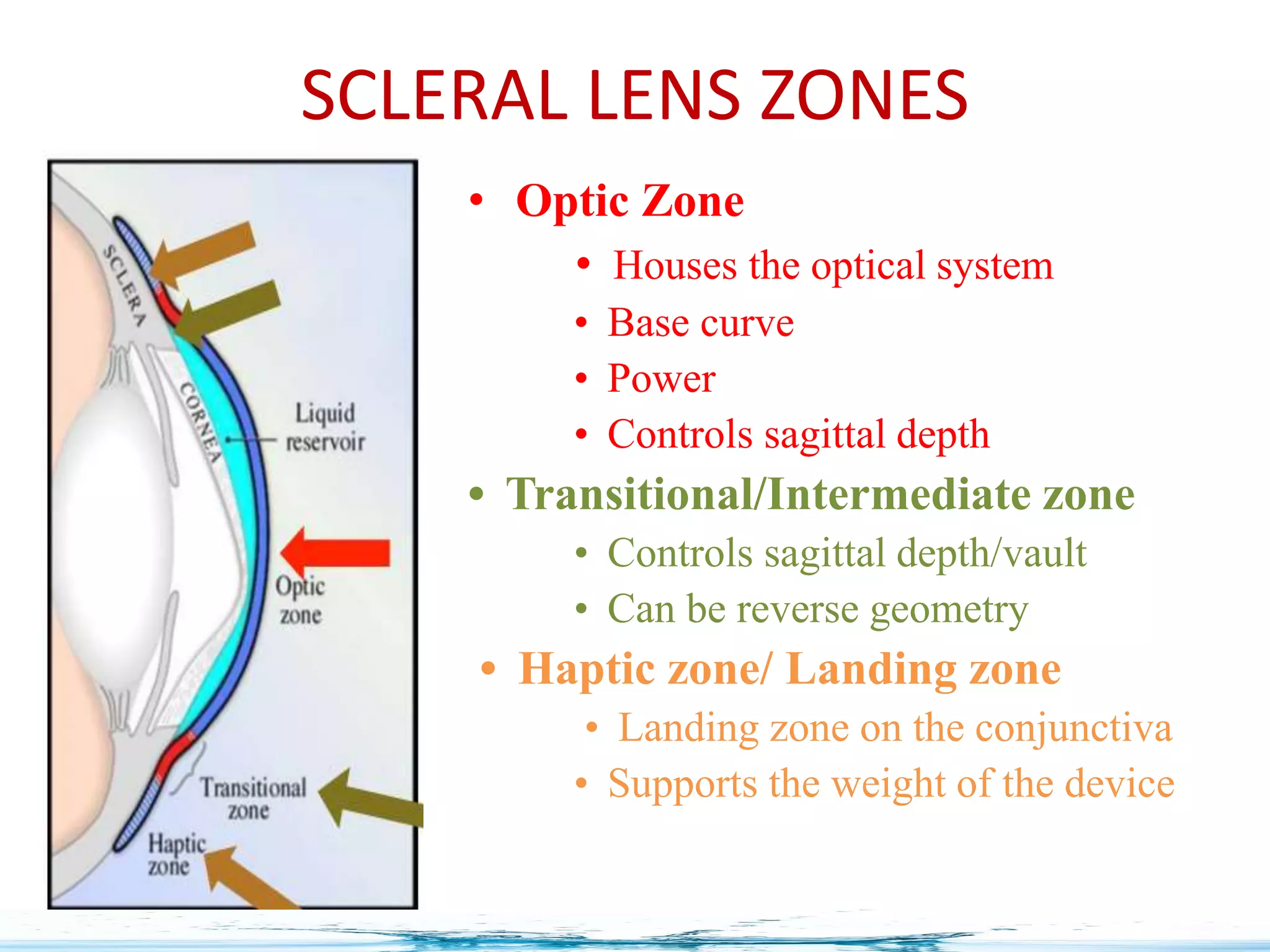 Scleral contact lenses | PPTX