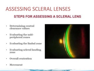 Scleral contact lenses | PPTX