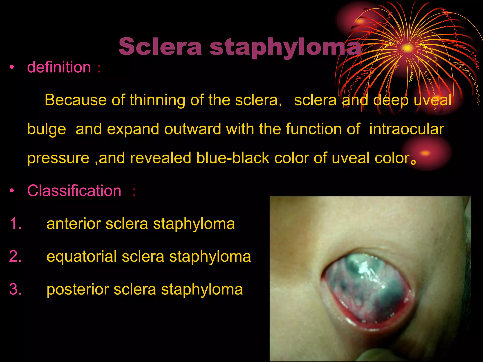 Sclera lecture by dr abdul basir safi | PDF