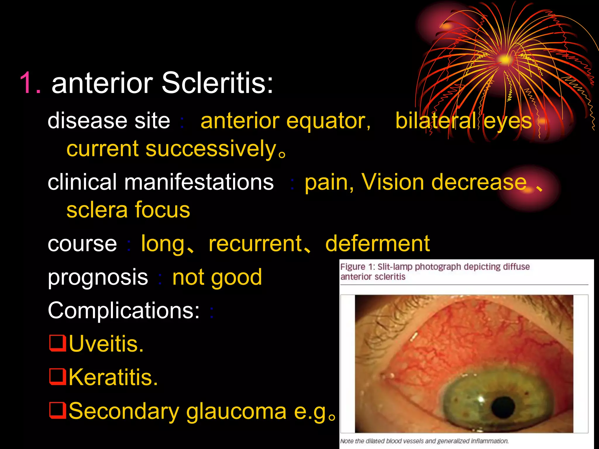 Sclera lecture by dr abdul basir safi | PDF