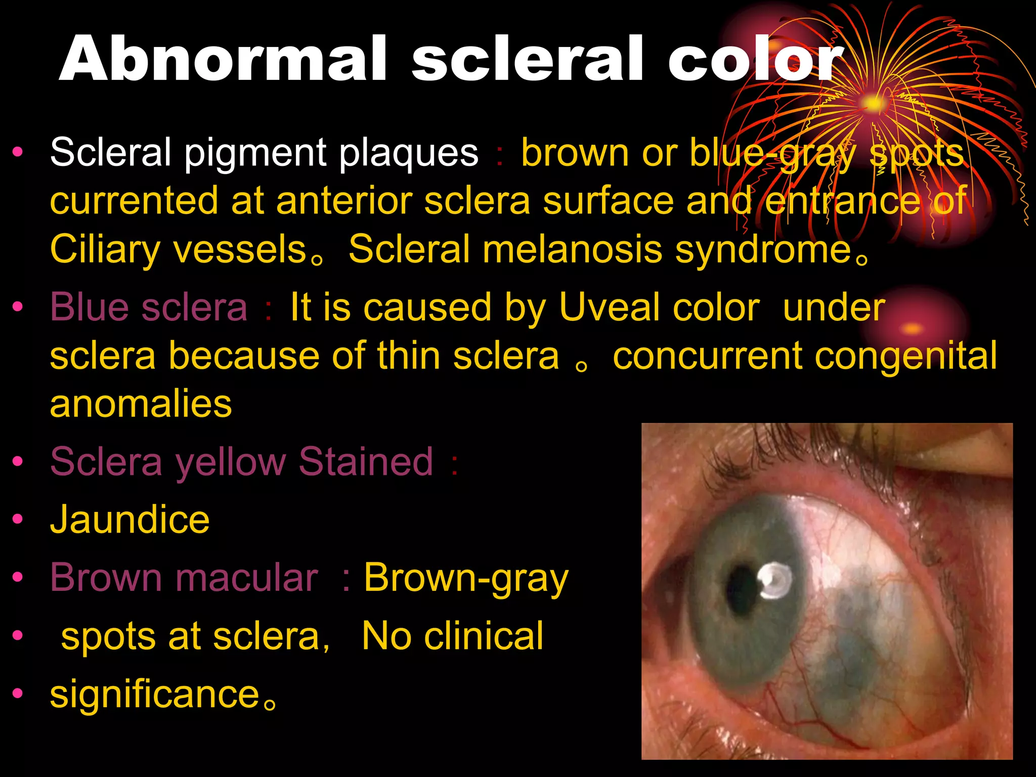 Sclera lecture by dr abdul basir safi