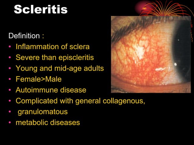 Sclera lecture by dr abdul basir safi | PPT