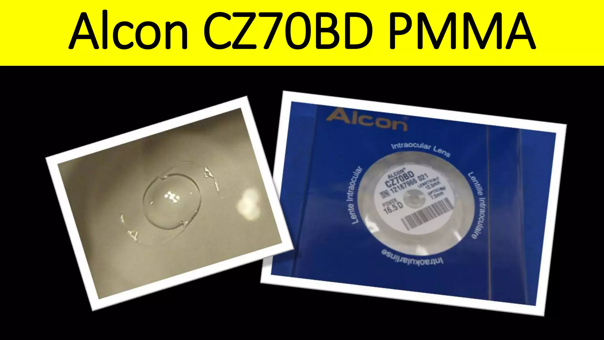 Scleral fixation technique | PPTX