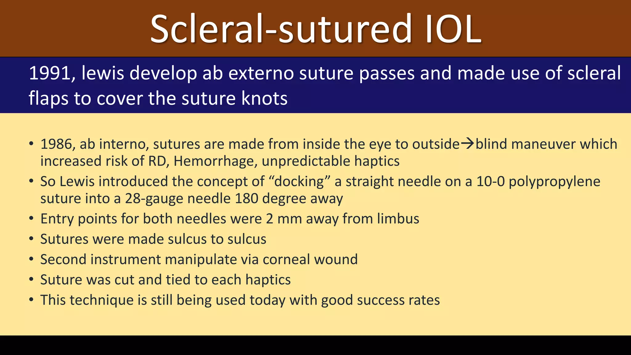 Scleral fixation technique | PPTX