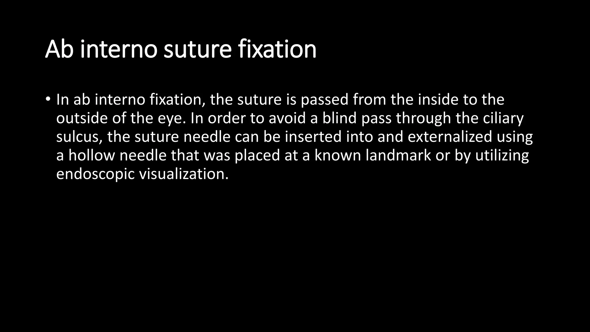 Scleral fixation technique | PPTX