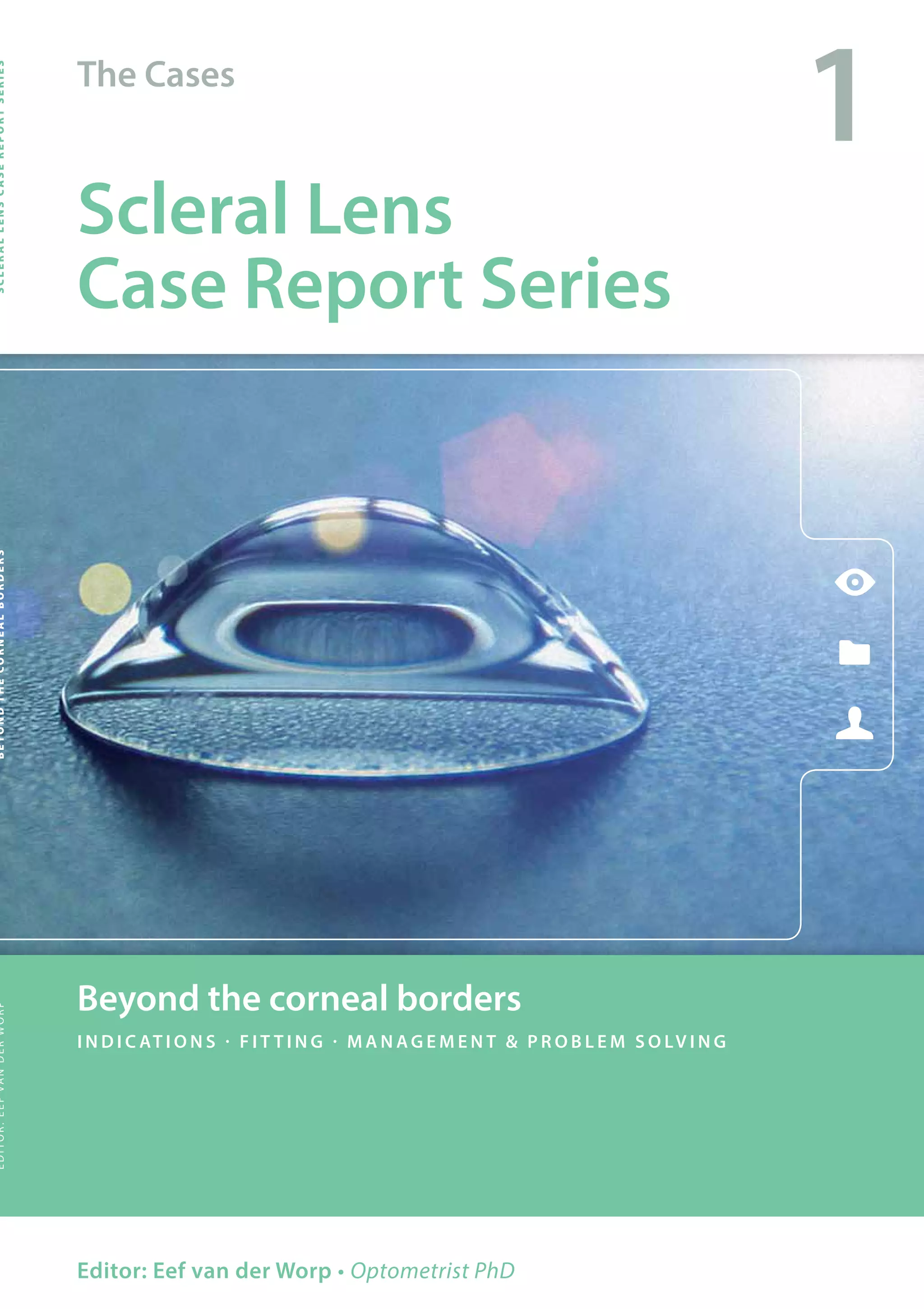 Scleral lens case report series beyond the corneal borders | PDF