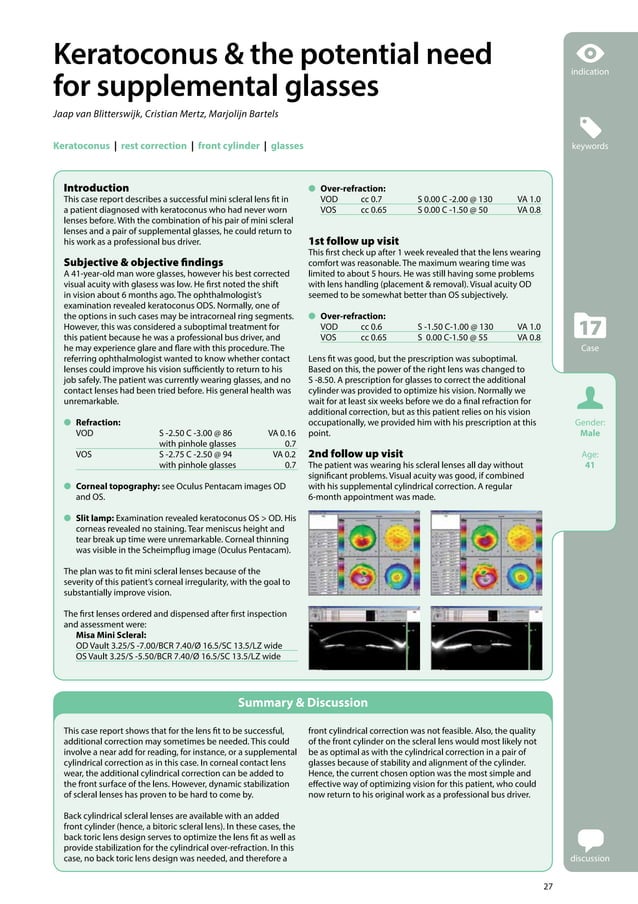 Scleral lens case report series beyond the corneal borders | PDF | Eye ...