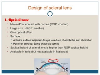 Scleral lenses | PPT