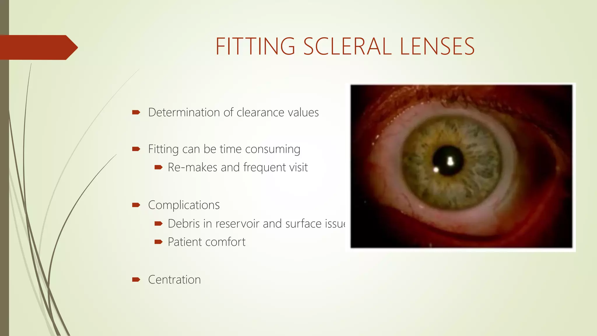 Scleral lens fitting | PPT