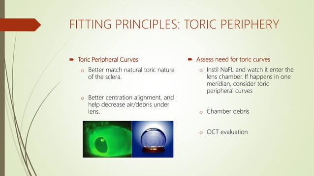 Scleral lens fitting | PPT | Eye and Vision Conditions | Diseases and Conditions