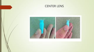 Scleral lens fitting | PPT