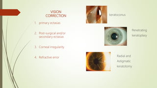 Scleral lens fitting | PPT