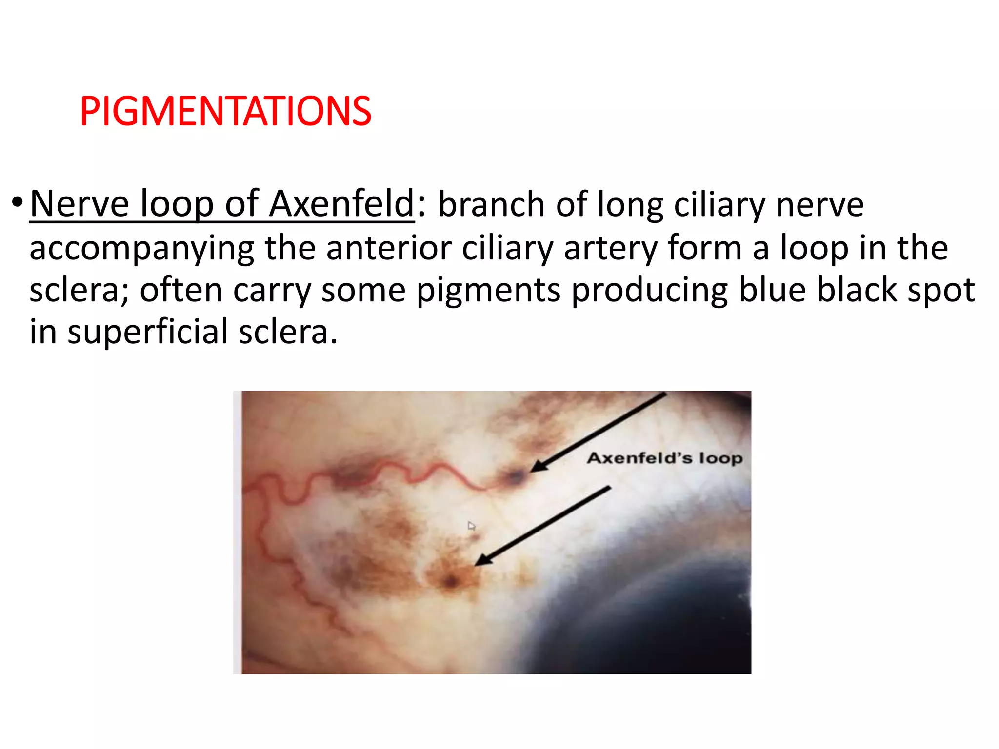 Tenon capsule ,Sclera and limbus : subash | PPTX
