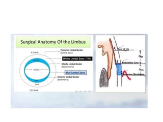 Tenons Capsule Histology