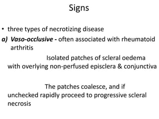 Scleritis | PPTX