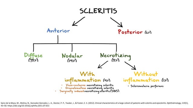 Scleritis (Inflammation of Sclera) | PPT