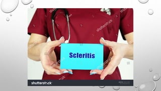 SCLERITIS.pptx