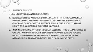 SCLERITIS.pptx