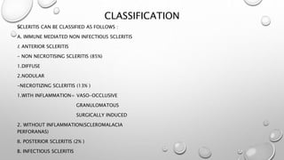 SCLERITIS.pptx