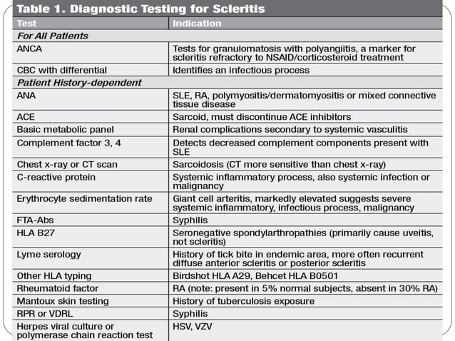 SCLERITIS- various presentations ,investigations and treatment ...