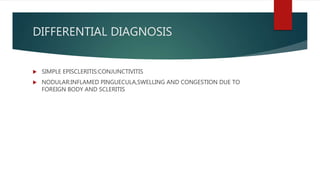 Scleritis and episcleritis | PPTX
