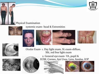 Scleritis & episcleritis | PPTX