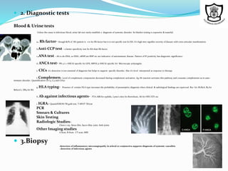Scleritis & episcleritis | PPTX