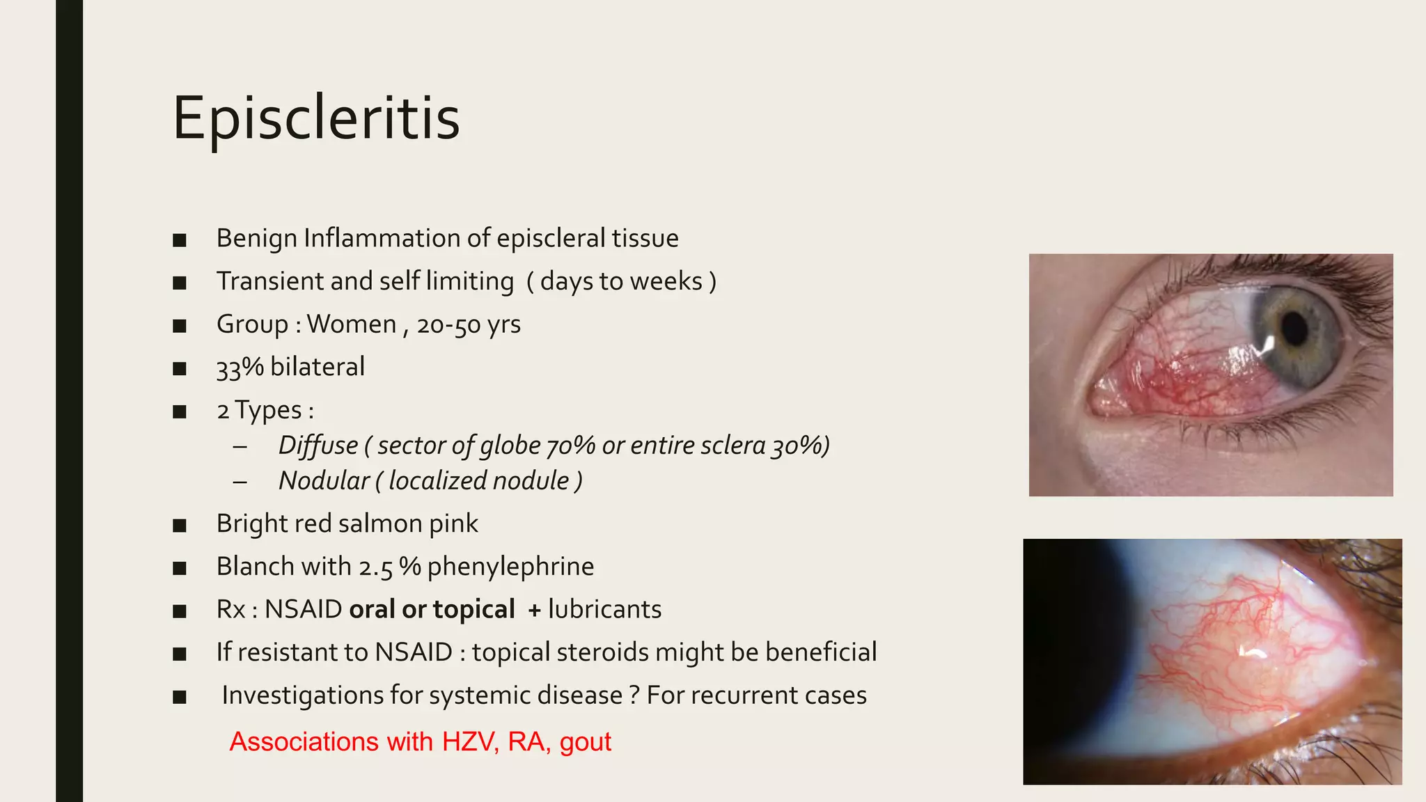 Scleritits. episcleritis | PPTX