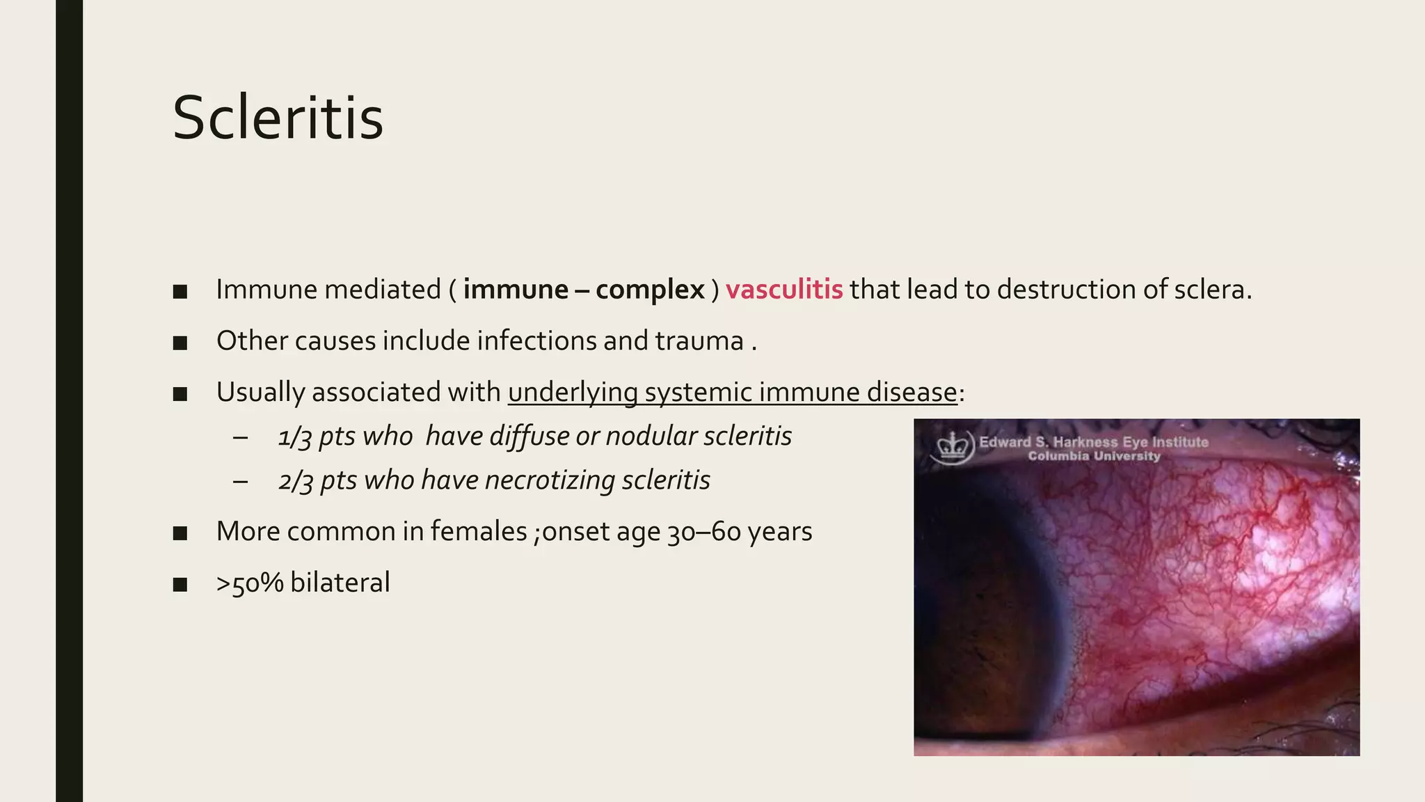 Scleritits. episcleritis | PPTX