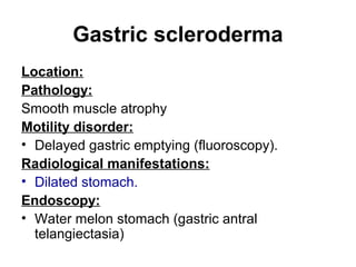 Scleroderma | PPT