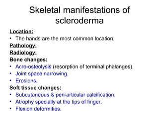 Scleroderma | PPT